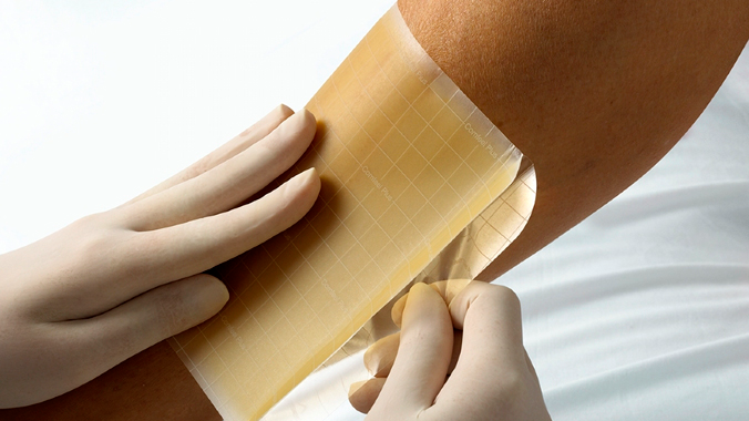 Os Benefícios do Curativo Hidrocoloide Hydrocoll para Feridas e Lesões Superficiais - Só Pele ...